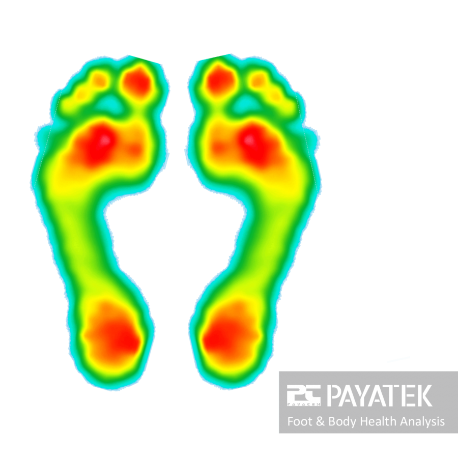Foot Pressure Scanner - Foot Pressure mapping Mat | PayaTek