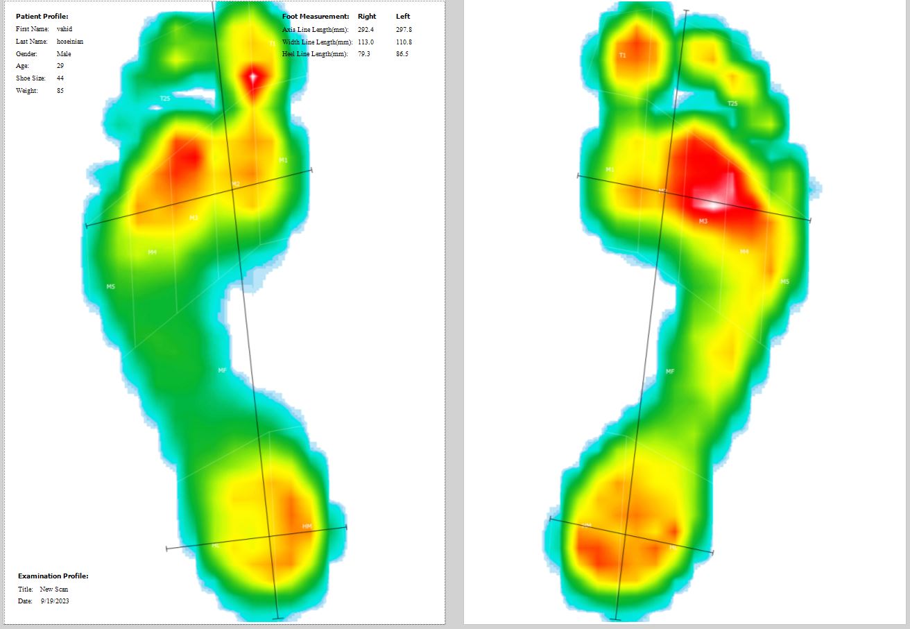 Foot Pressure Scanner - Foot Pressure mapping Mat | PayaTek